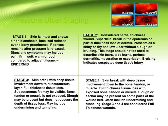 pressure-ulcer.ppt