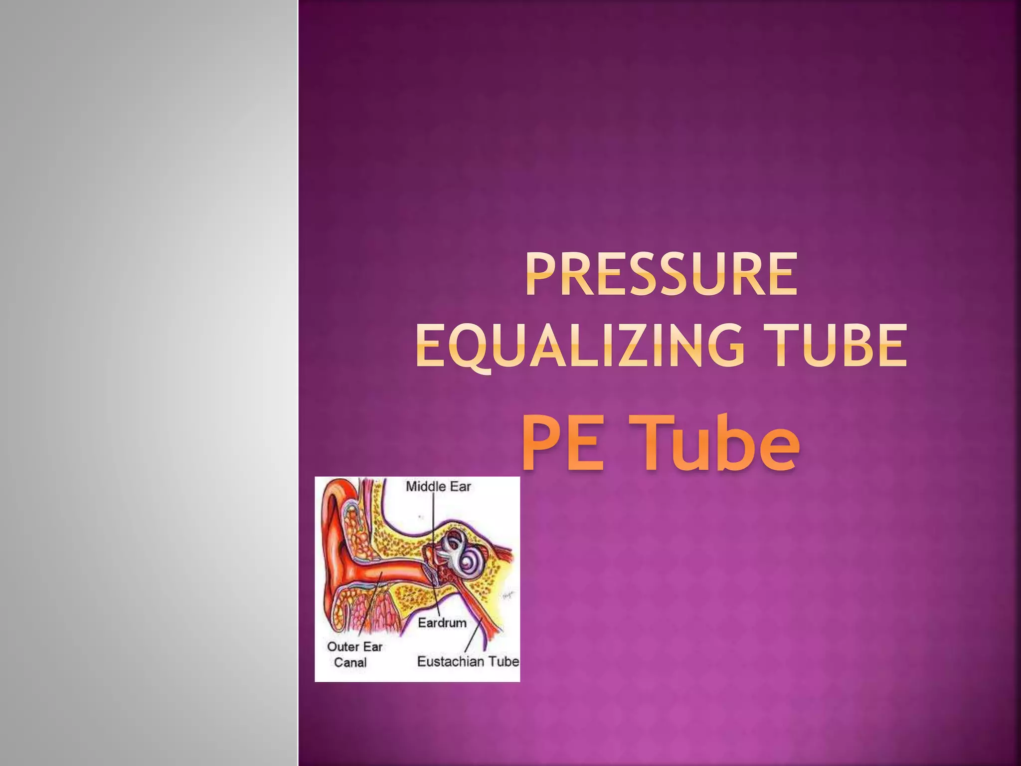 Pressure equalizing tube | PPTX