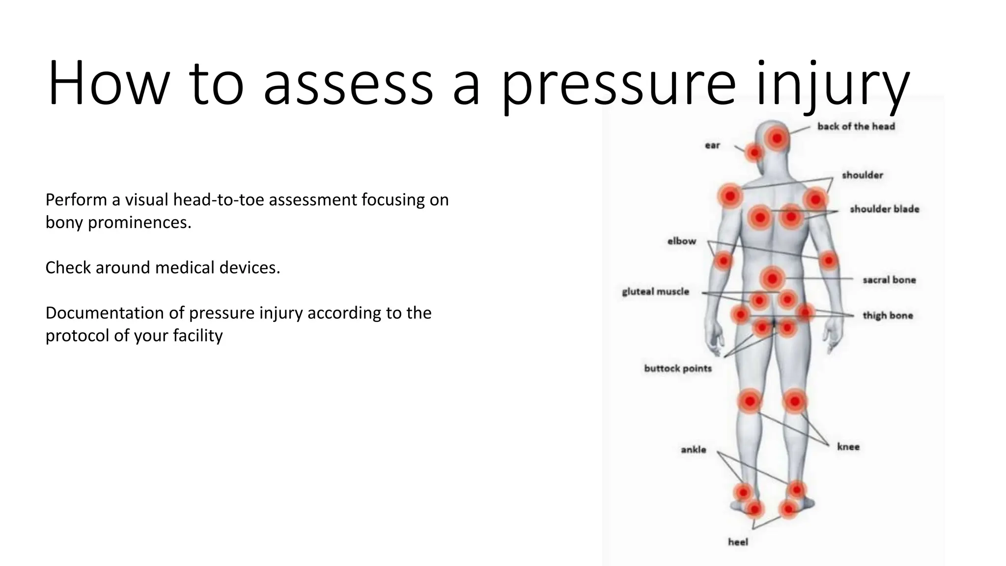 say no to pressure injury(pathophysiology, prevention, management) | PPTX