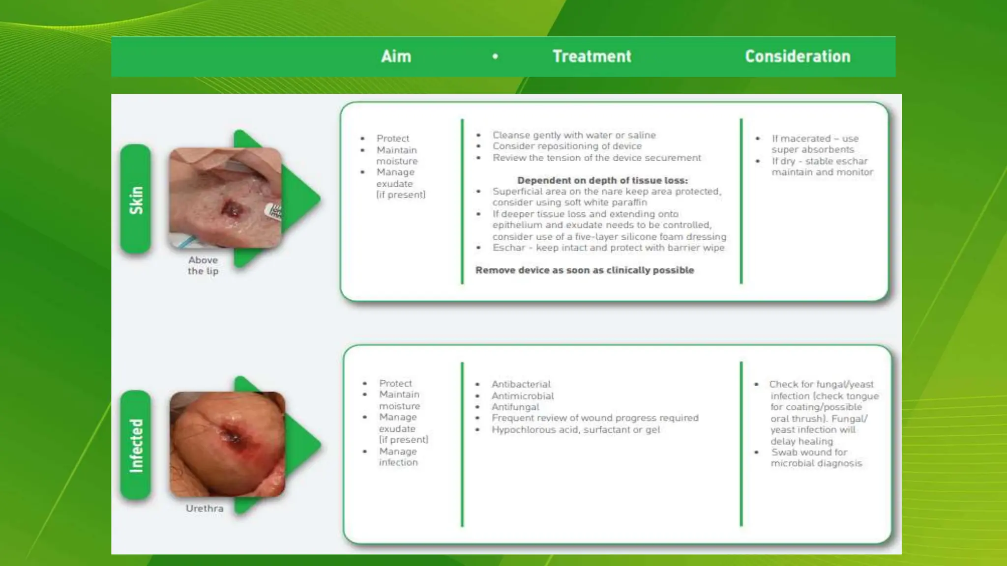 say no to pressure injury(pathophysiology, prevention, management) | PPTX