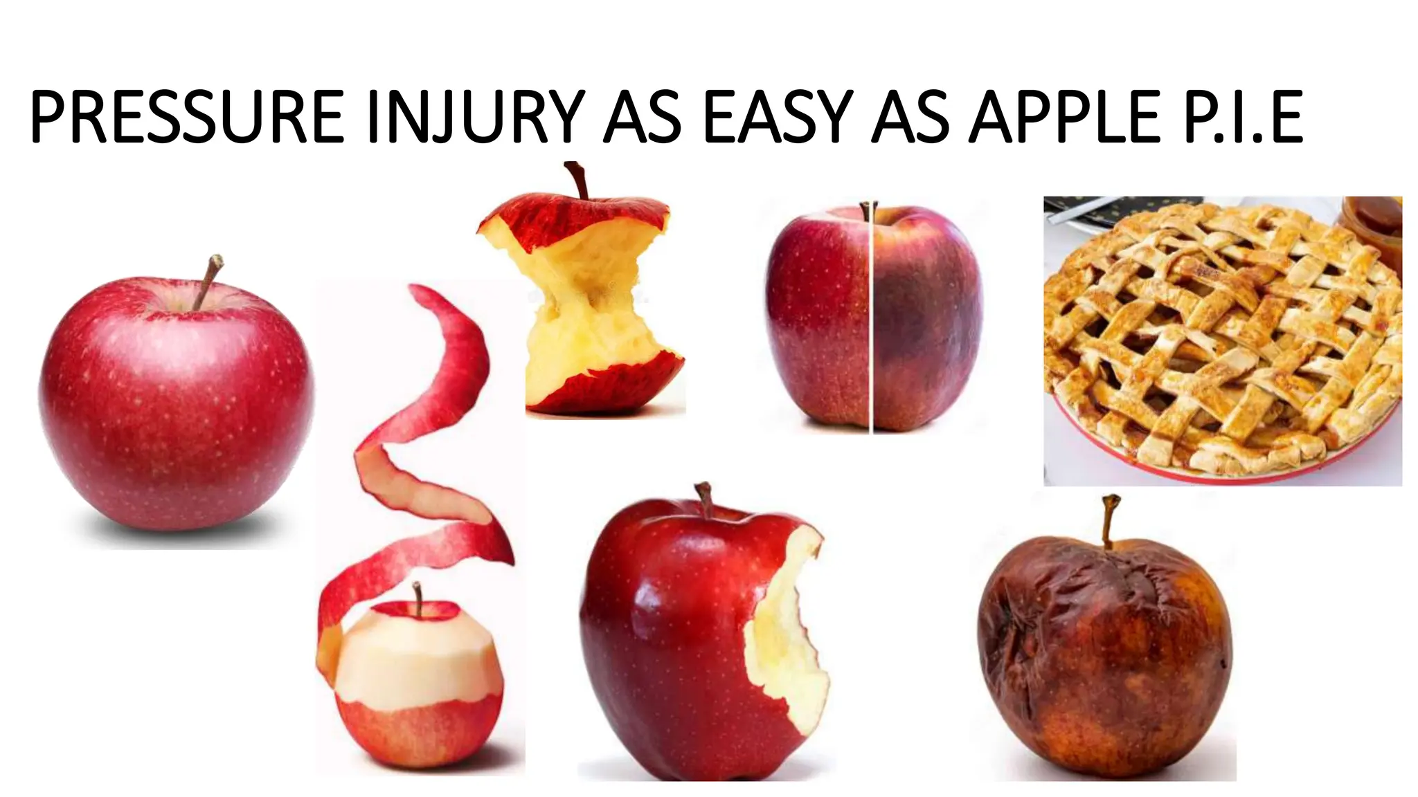 say no to pressure injury(pathophysiology, prevention, management) | PPTX