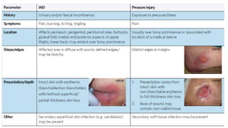say no to pressure injury(pathophysiology, prevention, management) | PPTX