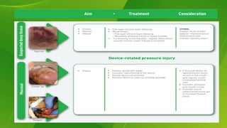 say no to pressure injury(pathophysiology, prevention, management) | PPTX