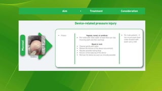 say no to pressure injury(pathophysiology, prevention, management) | PPTX