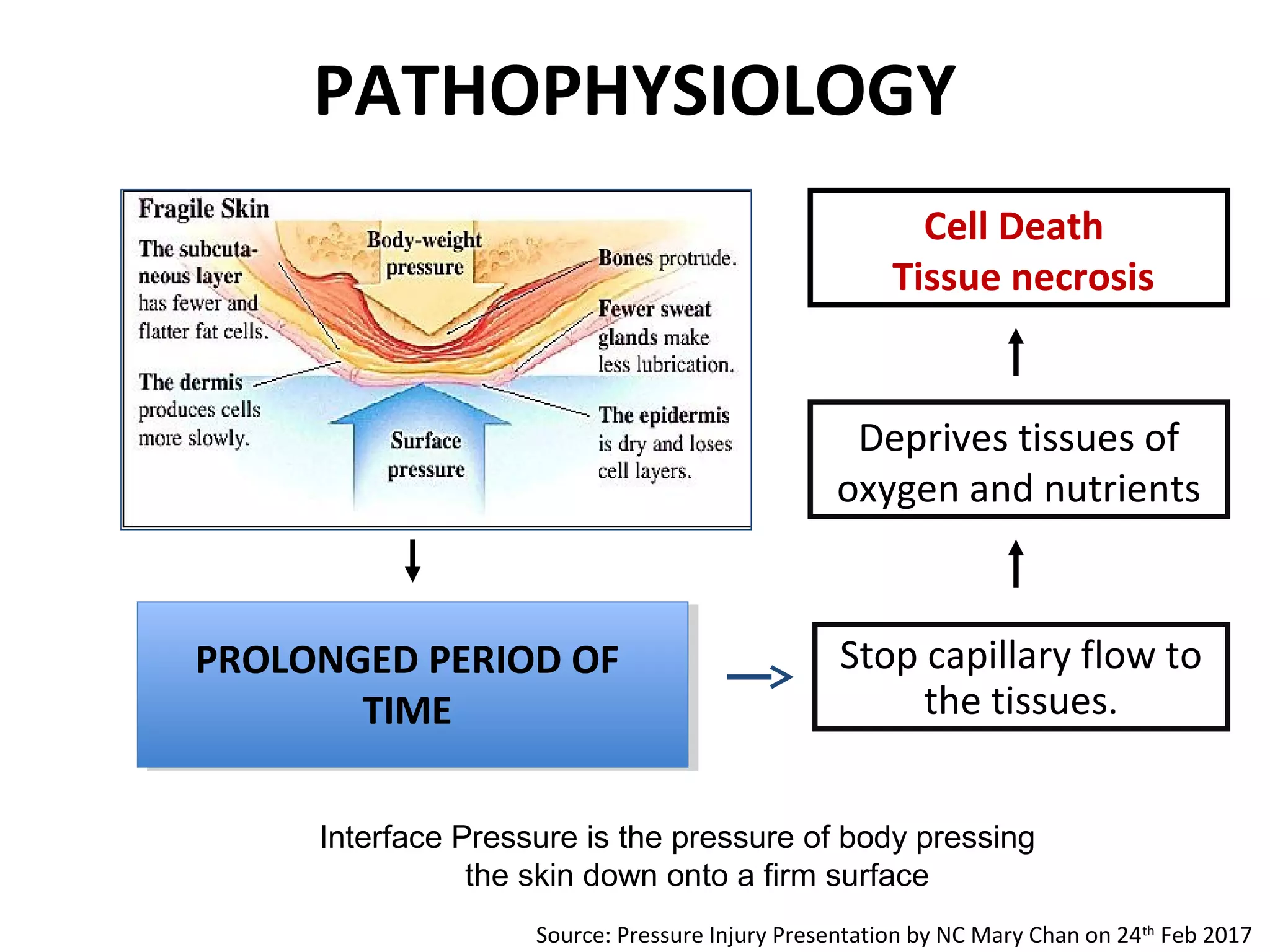 Pressure Injury | PPT