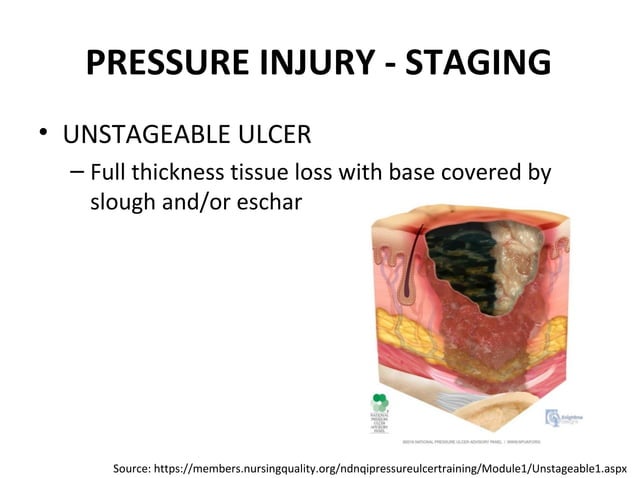 Pressure Injury | PPT | First Aid | Injuries
