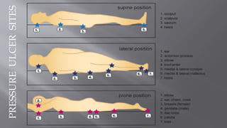 PRESSURE INJURY PREVENTION & MANAGEMENT.pptx