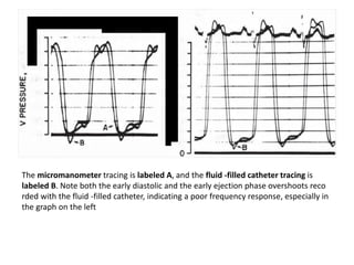 PRESSURE MEASUREMENT by Cardiac catheterisation_Dr Amol Patil.pptx
