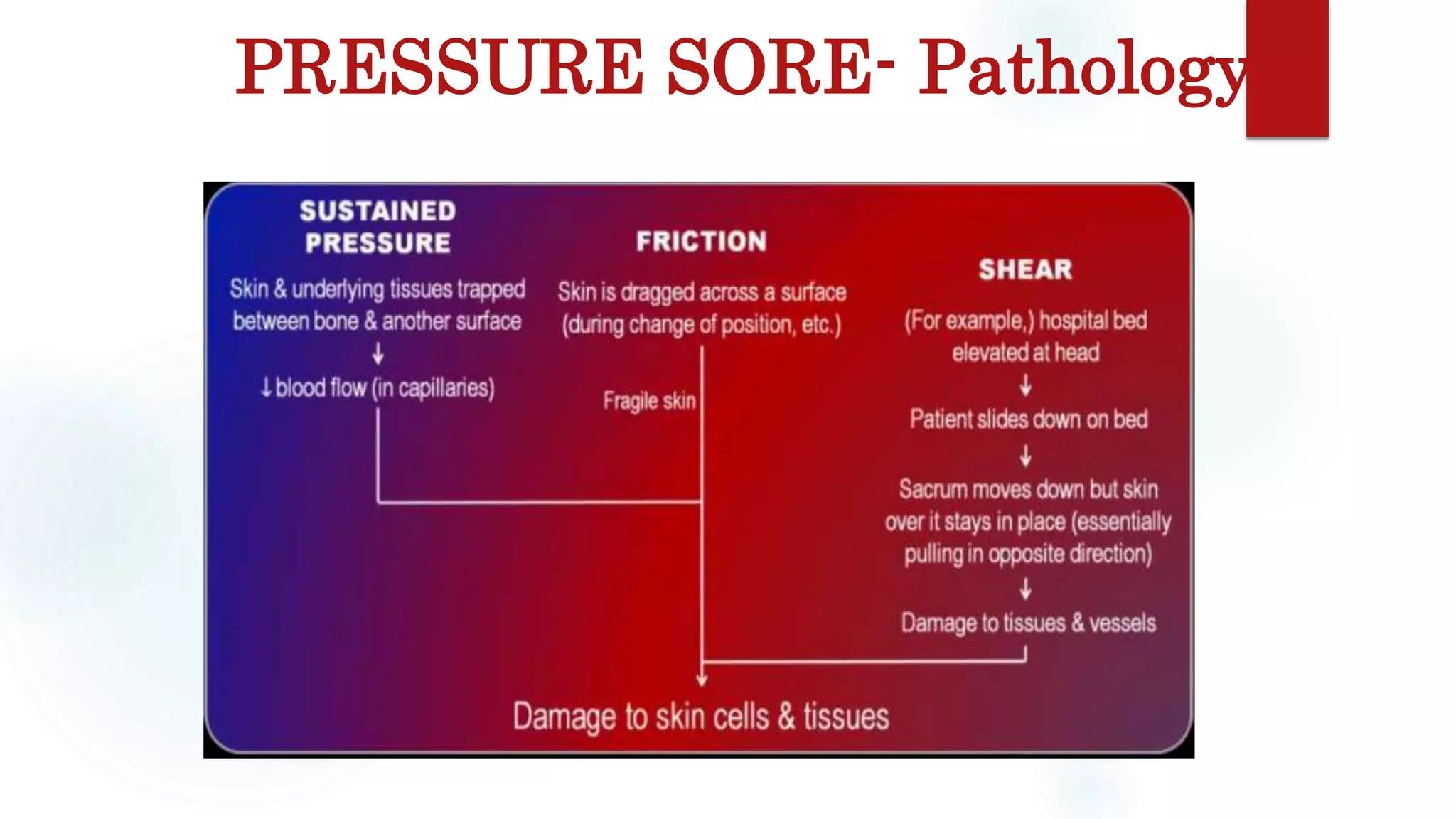 PRESSURE SORE/BED SORE/DECUBITUS ULCER | PPTX