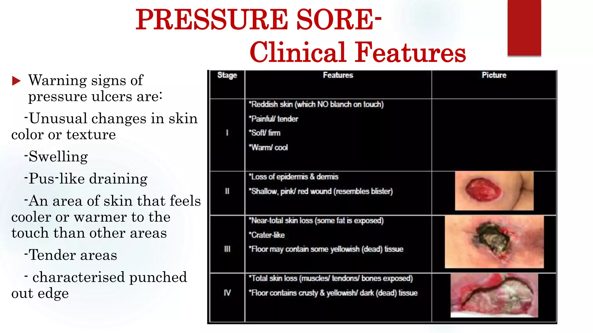 PRESSURE SORE/BED SORE/DECUBITUS ULCER | PPTX