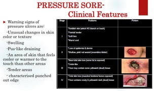 PRESSURE SORE/BED SORE/DECUBITUS ULCER | PPTX