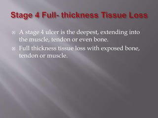 Pressure sore | PPTX