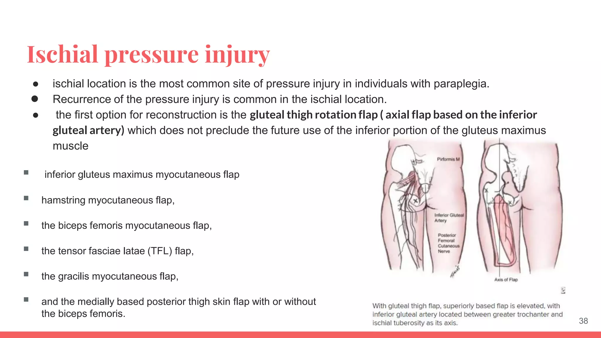 Pressure sore | PPTX