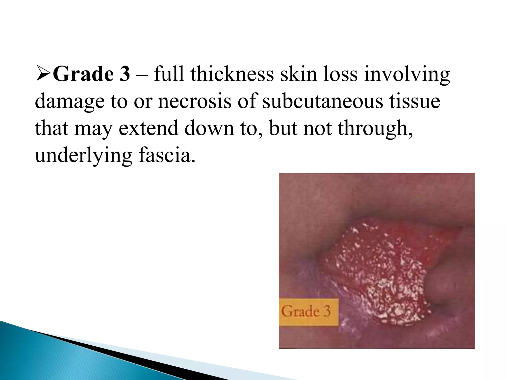 pressure sore.ppt