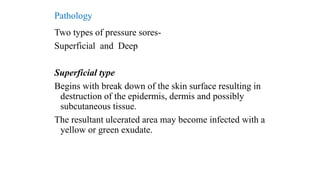 Pressure sore kk 29.pptx