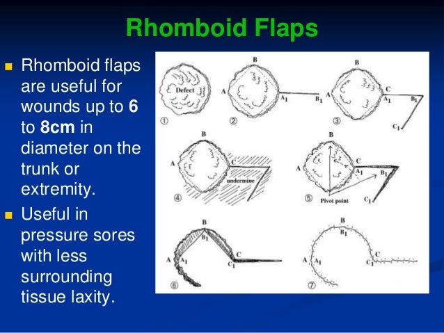 Pressure sore management