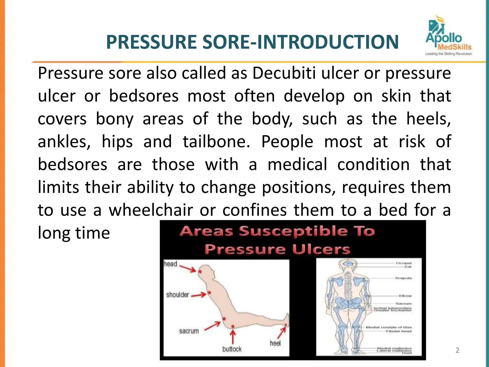 Pressure sores prevention & Risk assessment.pptx