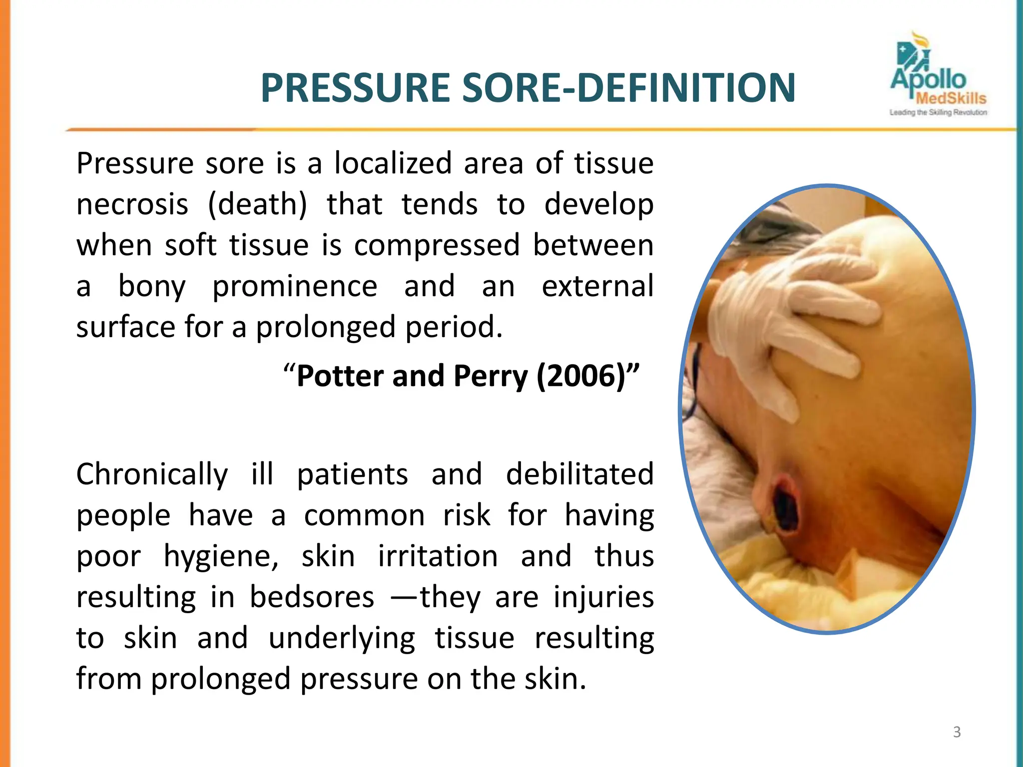 Pressure sores prevention & Risk assessment.pptx