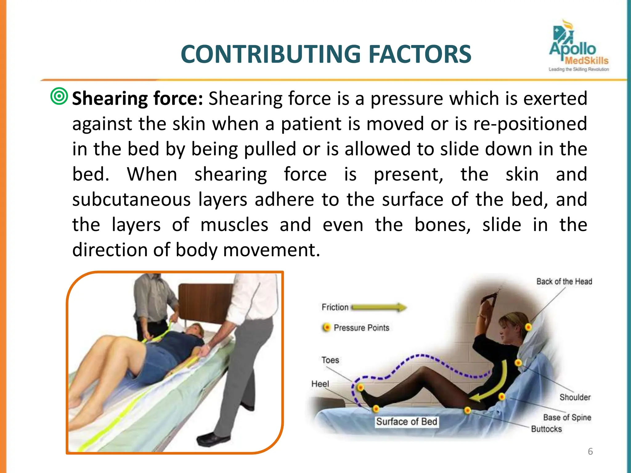 Pressure sores prevention & Risk assessment.pptx