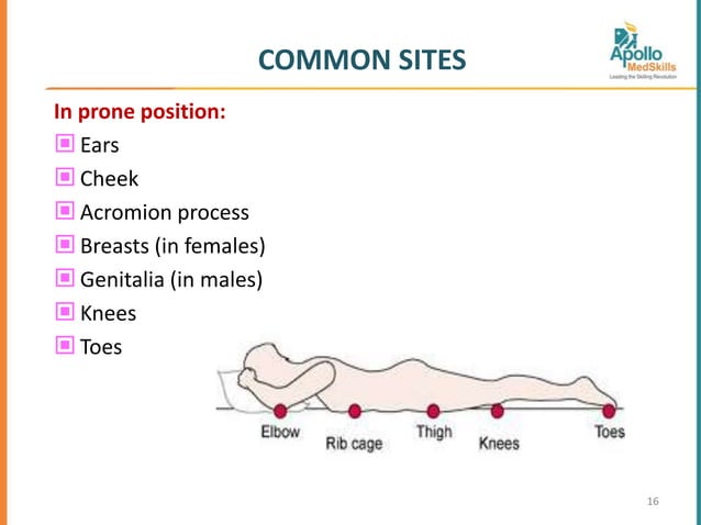 Pressure sores prevention & Risk assessment.pptx