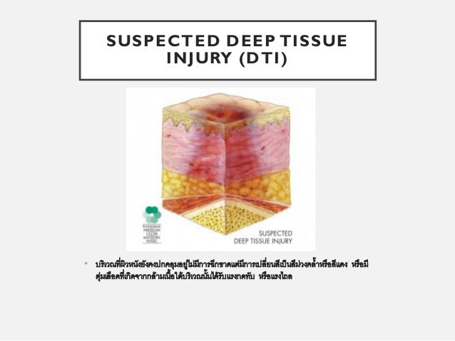 Pressure sore diagnosis and management for medical student