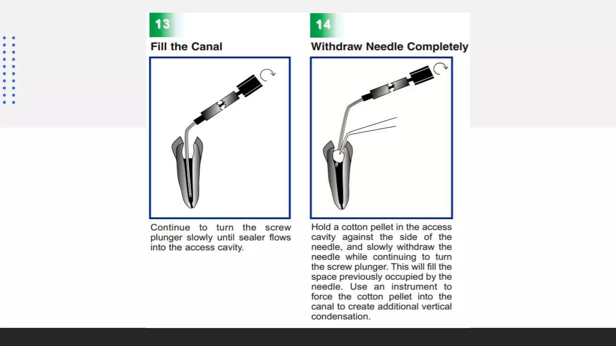 Pressure syringe | PPTX
