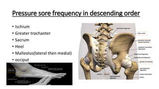 PRESSURE ULCER / BED SORE | PPTX