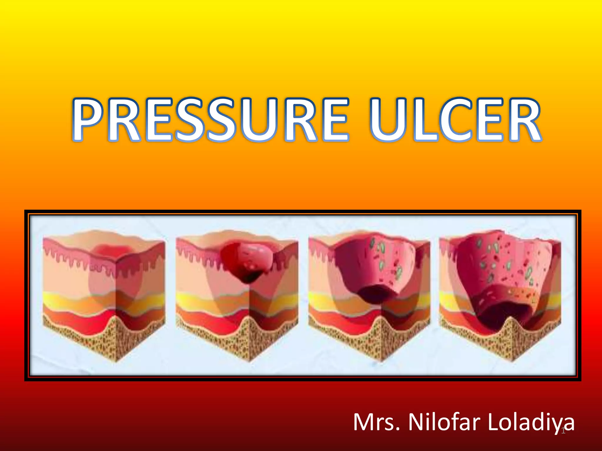 pressure ulcer.pptx