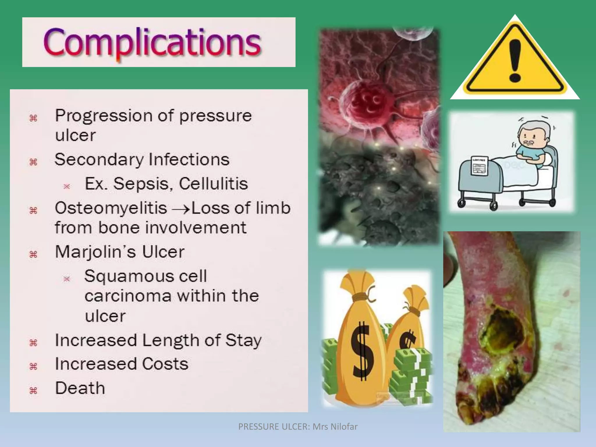pressure ulcer.pptx