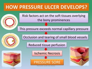 pressure ulcer.pptx