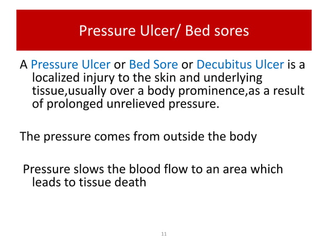 Pressure Ulcer.pptx by Amin.pptx