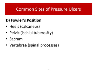 Pressure Ulcer.pptx by Amin.pptx