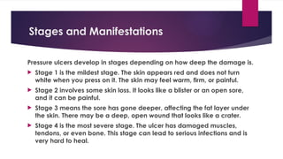 Pressure Ulcer: Stages, Causes, Prevention, and Nursing Management.pptx