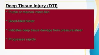 PRESSURE ULCER.pptx .................... | PPTX
