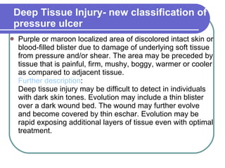Pressureulcerandwoundsextrahelp | PPT