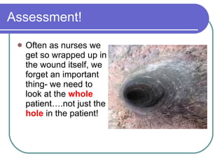 Pressureulcerandwoundsextrahelp | PPT