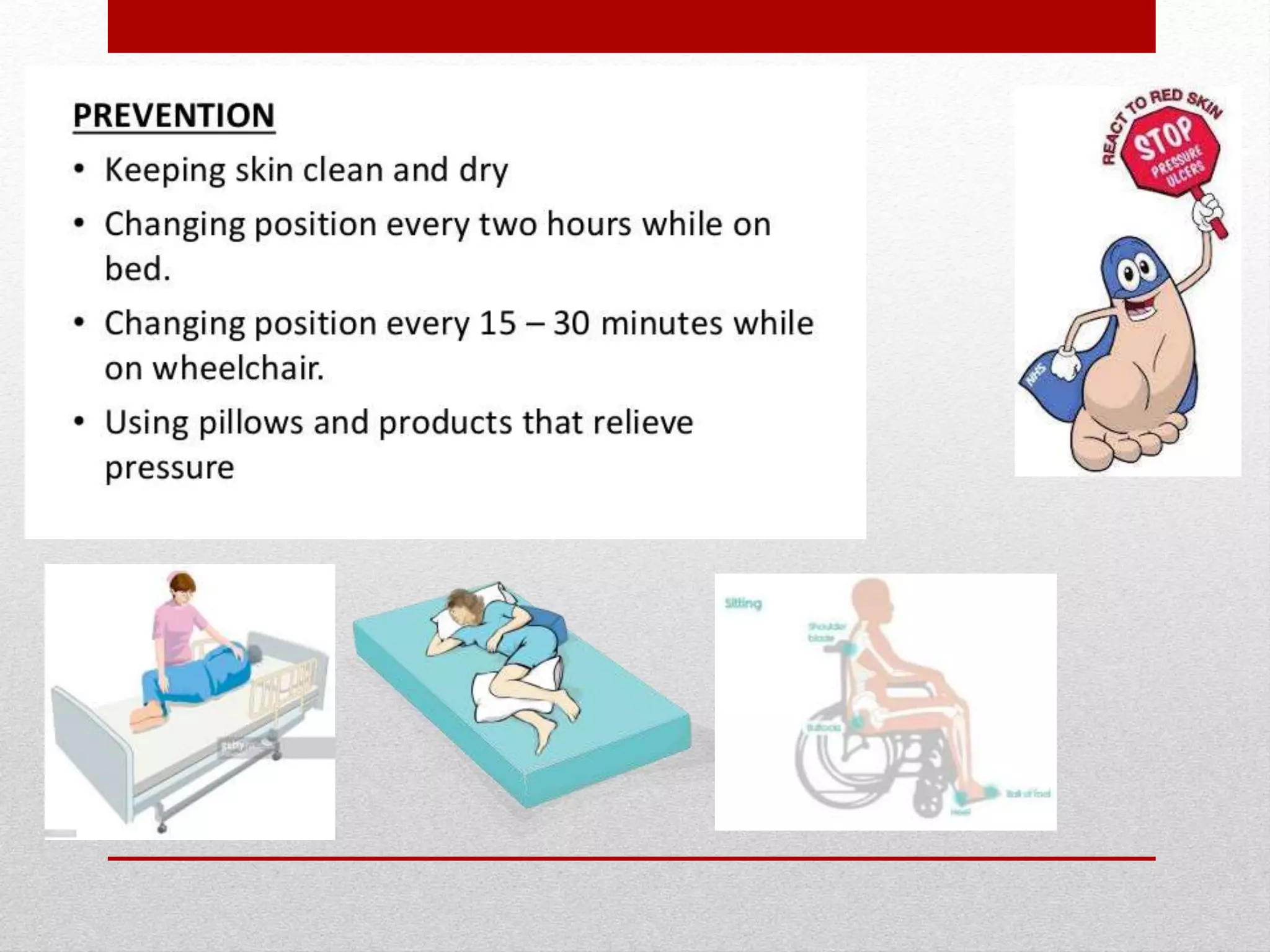 Pressure ulcer assessment prevention & reporting | PPTX