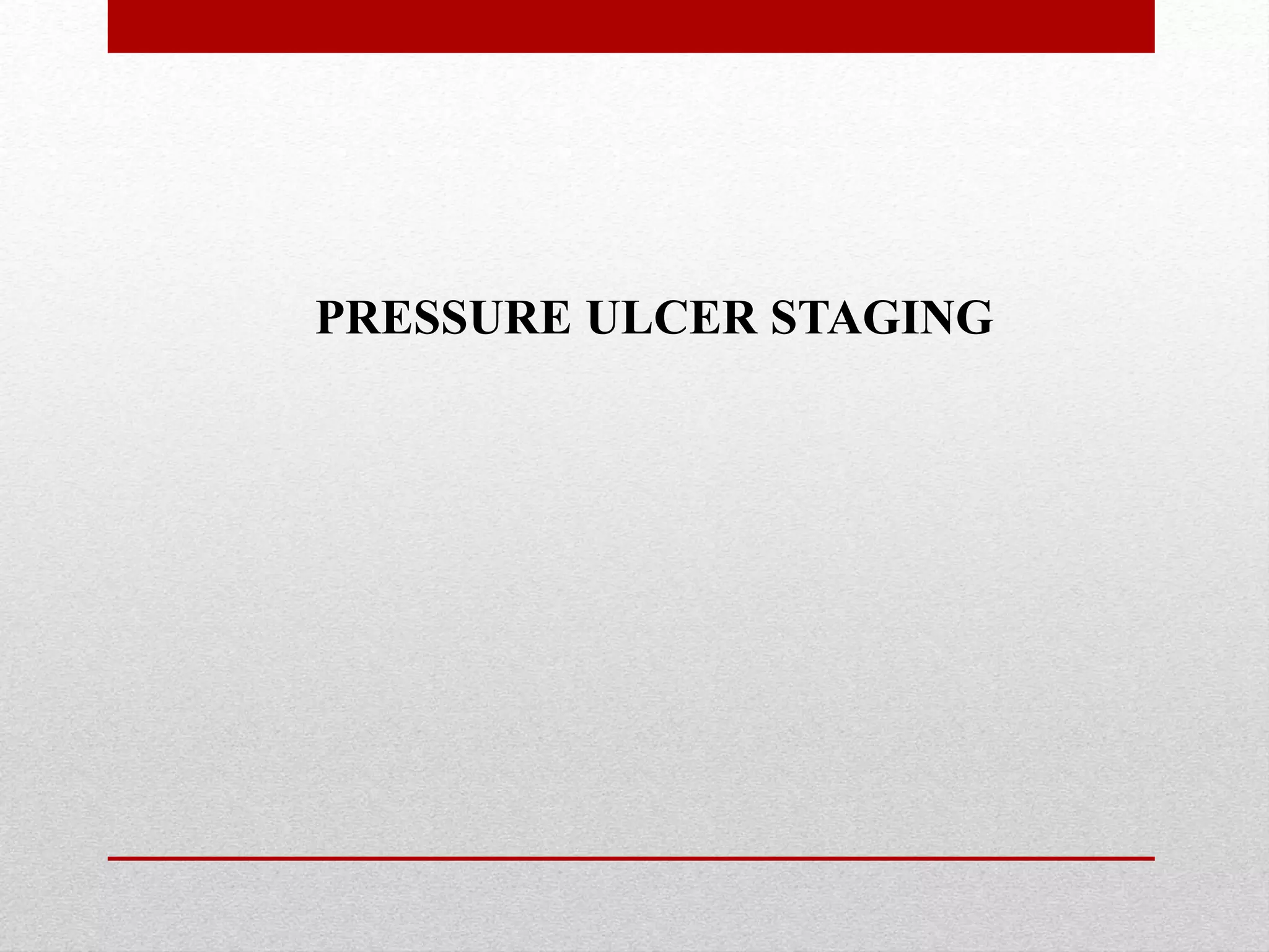 Pressure ulcer assessment prevention & reporting | PPTX