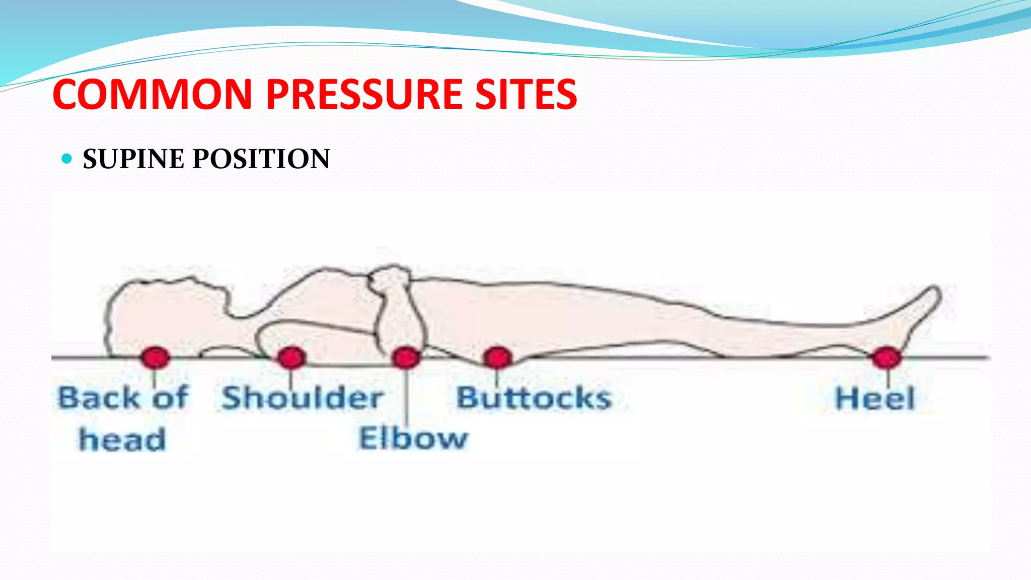 Pressure ulcer ppt | PPTX