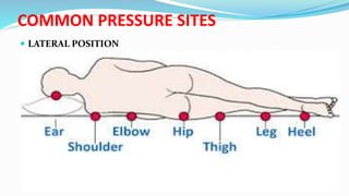 Pressure ulcer ppt | PPTX