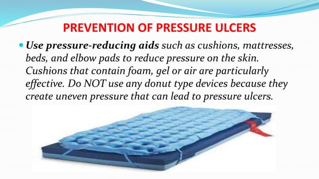 Pressure ulcer ppt | PPTX