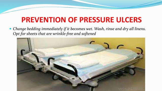Pressure ulcer ppt | PPTX