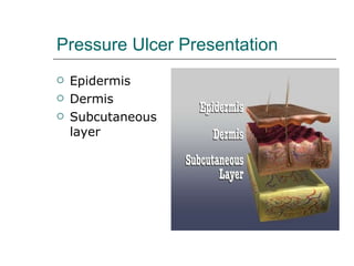 Pressure ulcer presentation3 | PPT