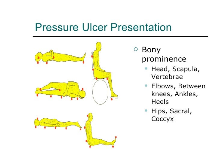 Pressure ulcer presentation3