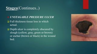 Pressure ulcer prevention and care.pptx