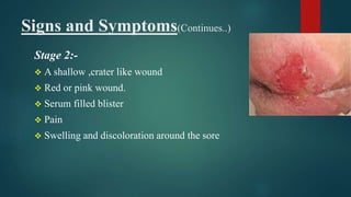 Pressure ulcer prevention and care.pptx