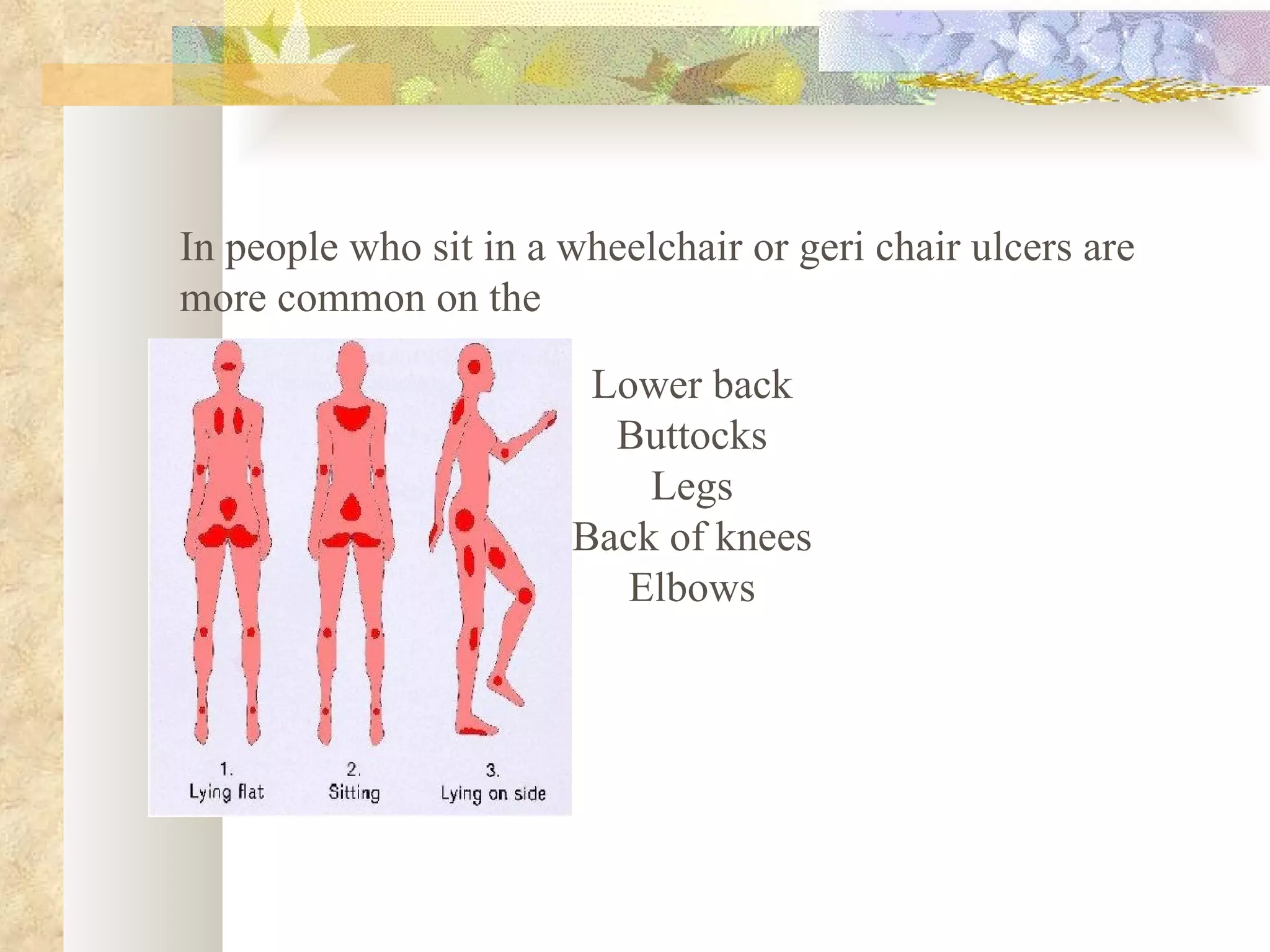 Pressure Ulcer Prevention & Skin Care | PPT