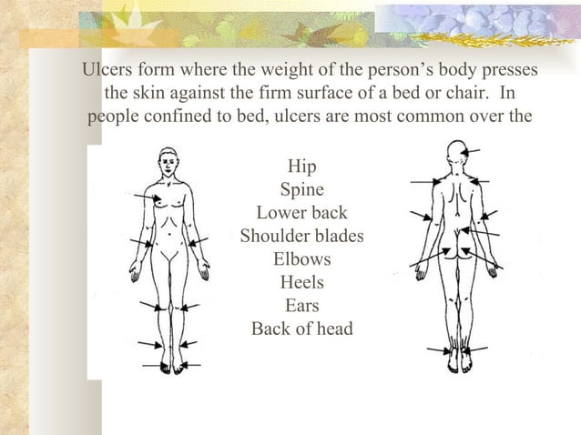 Pressure Ulcer Prevention & Skin Care | PPT | Skin and Dermatology ...
