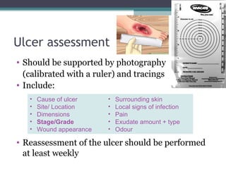 Pressure Ulcers - Mussa Mensa | PPT