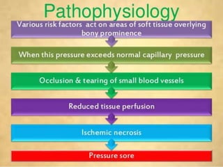 pressure ulcers model.pptx by dr amna hassan | PPTX